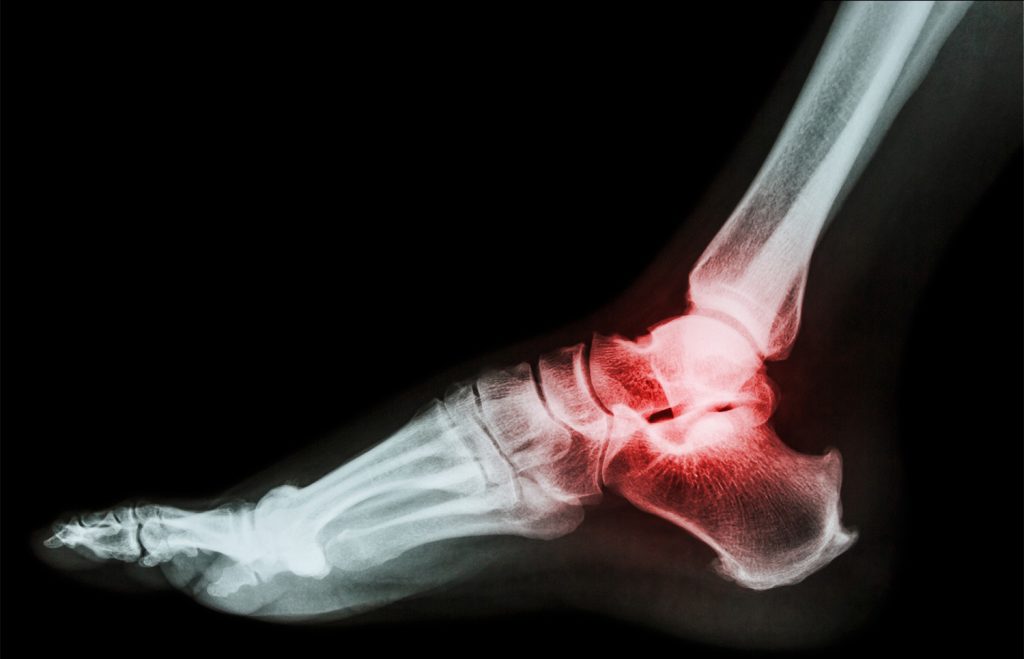 Musculoskeletal scans - Ultrasound Services