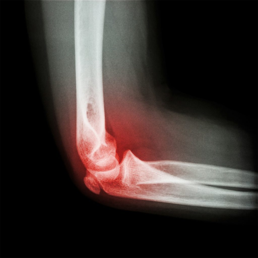 Musculoskeletal scans - Ultrasound Services