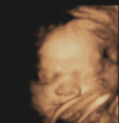 3D & 4D Pregnancy Baby Scans in London - Ultrasound Services